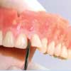 AvaDent introduces the Advanced Try-In Option | Dentistry IQ