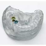 Objet printing | Dentistry IQ