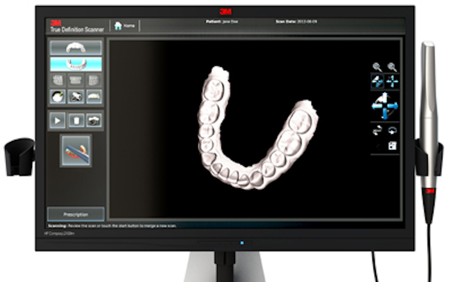 3M Digital Oral Care announces tech upgrades to scanner system ...