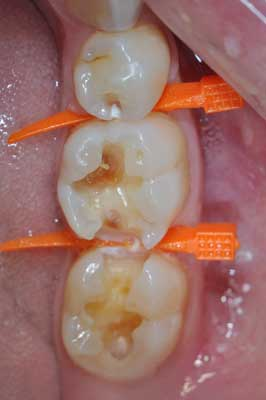 3 things a matrix system must do to be successful | Dentistry IQ