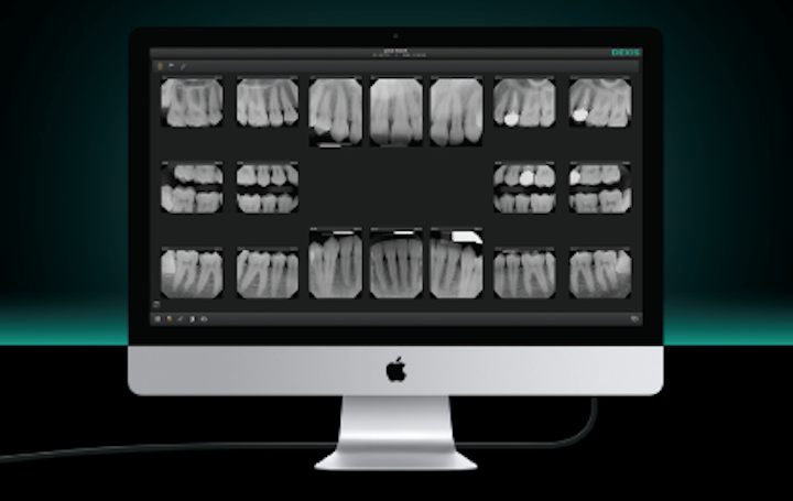 Dexis debuts imaging software for Mac at CDA in San Francisco | DentistryIQ