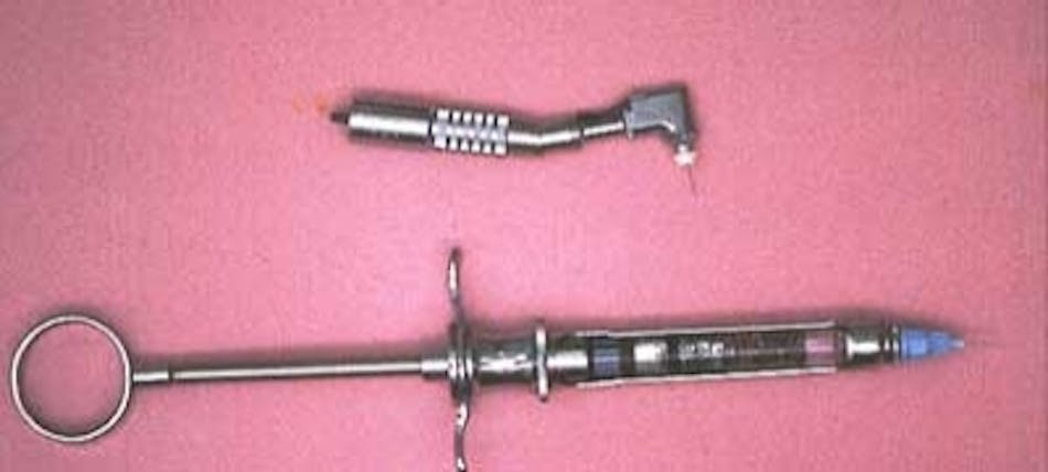 Intraosseous local anesthesia | Dentistry IQ