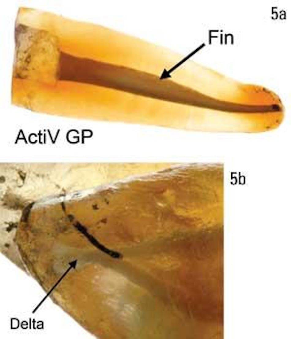 Introducing the Activ GP Precision Obturation System | Dentistry IQ