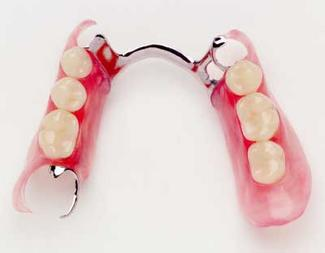 Valplast — The flexible partial | Dentistry IQ