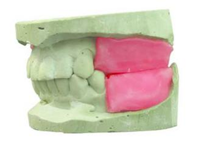 Valplast — The flexible partial | DentistryIQ