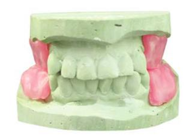 Valplast — The flexible partial | DentistryIQ