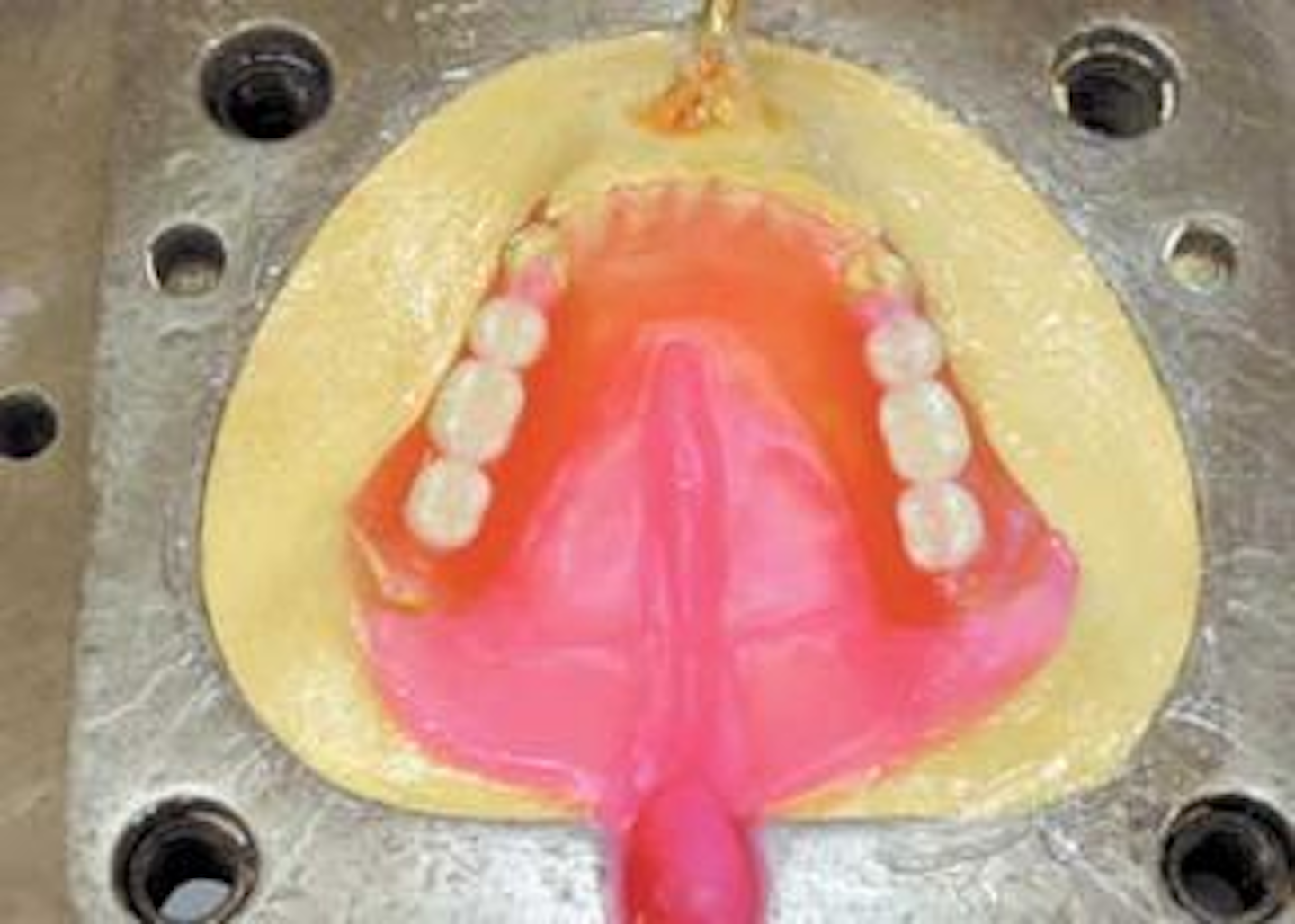 Valplast — The flexible partial | DentistryIQ