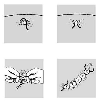 Secrets to successful dental dam placement | Dentistry IQ