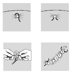 Secrets to successful dental dam placement | Dentistry IQ