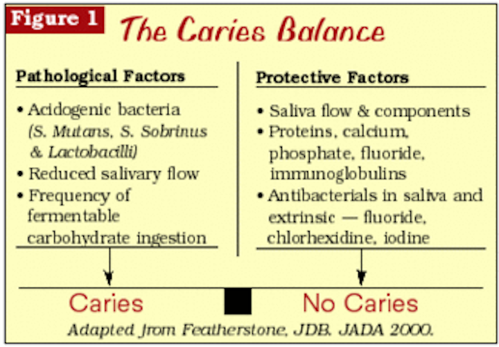 Focus on Dental Caries Management | DentistryIQ