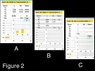 Lasers and bacterial reduction: A comprehensive technique to treat ...