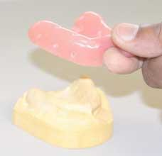 Trident's Premium Portrait® IPN®Dentures | Dentistry IQ