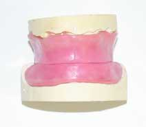 Trident's Premium Portrait® IPN®Dentures | Dentistry IQ