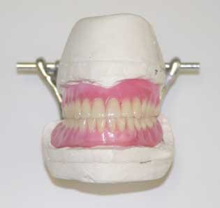 Trident's Premium Portrait® IPN®Dentures | Dentistry IQ
