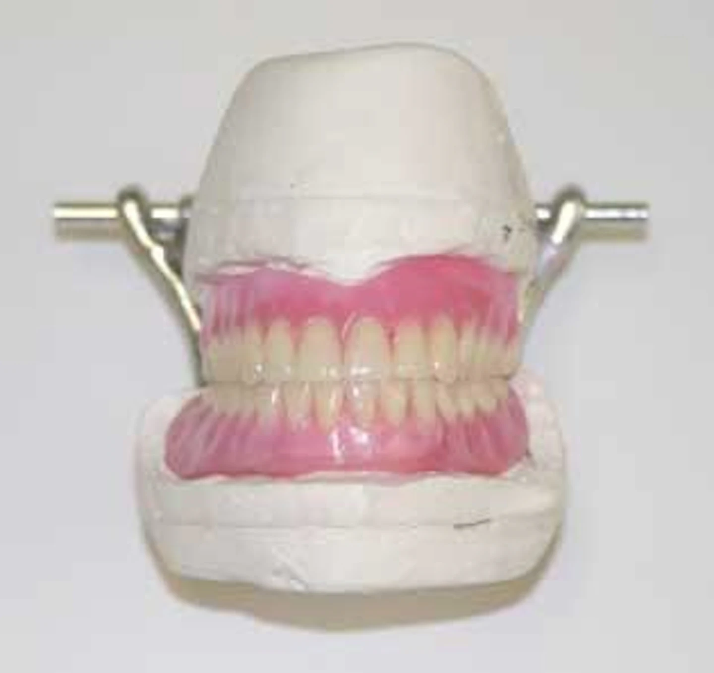 Trident's Premium Portrait® IPN®Dentures | DentistryIQ