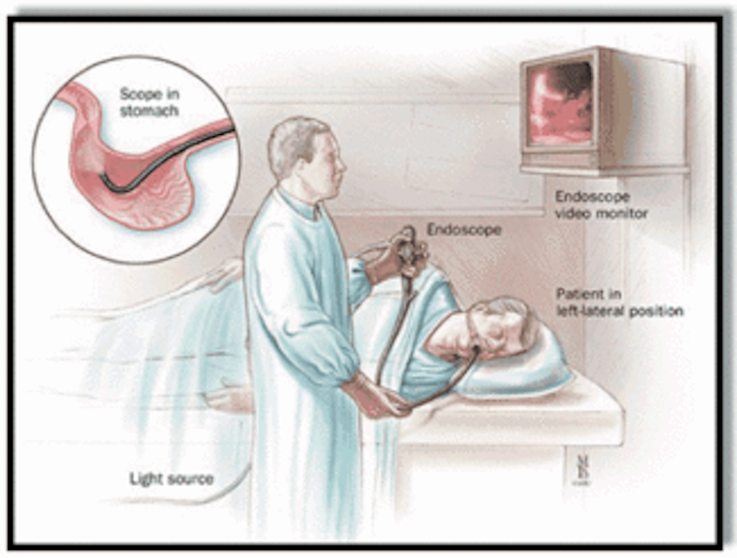 Understanding Acid Reflux and Its Dental Manifestations | DentistryIQ