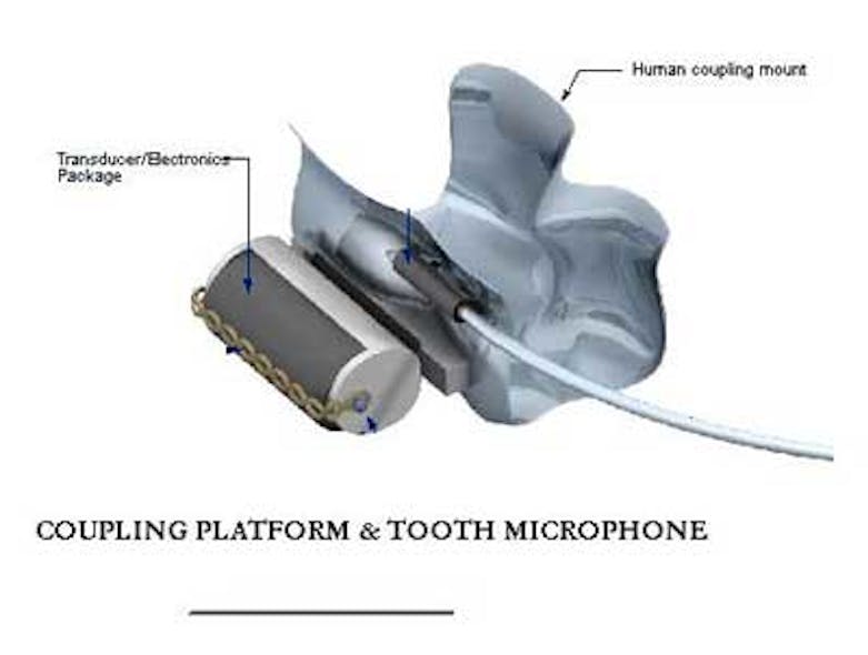 Research involving novel tooth microphone has potential to propel the ...