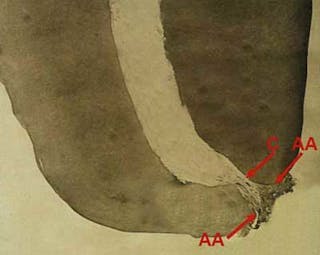 Endodontic insight: Where should the gutta-percha point end for optimal ...