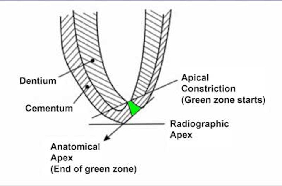 Endodontic insight: Where should the gutta-percha point end for optimal endodontic success ...