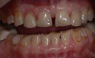 Digital photography in dentistry: Tools and techniques to help your ...