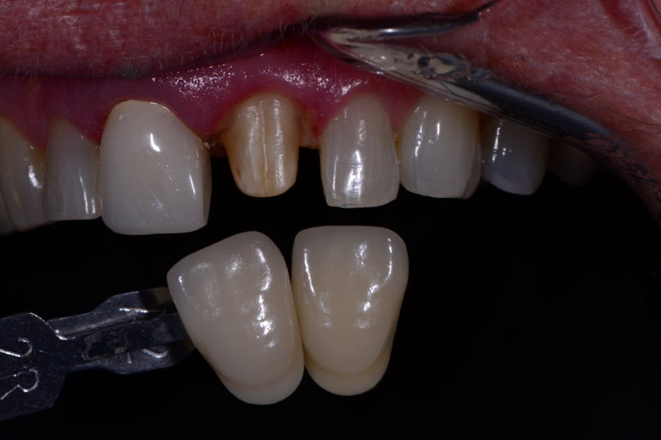 Digital photography in dentistry: Tools and techniques to help your ...