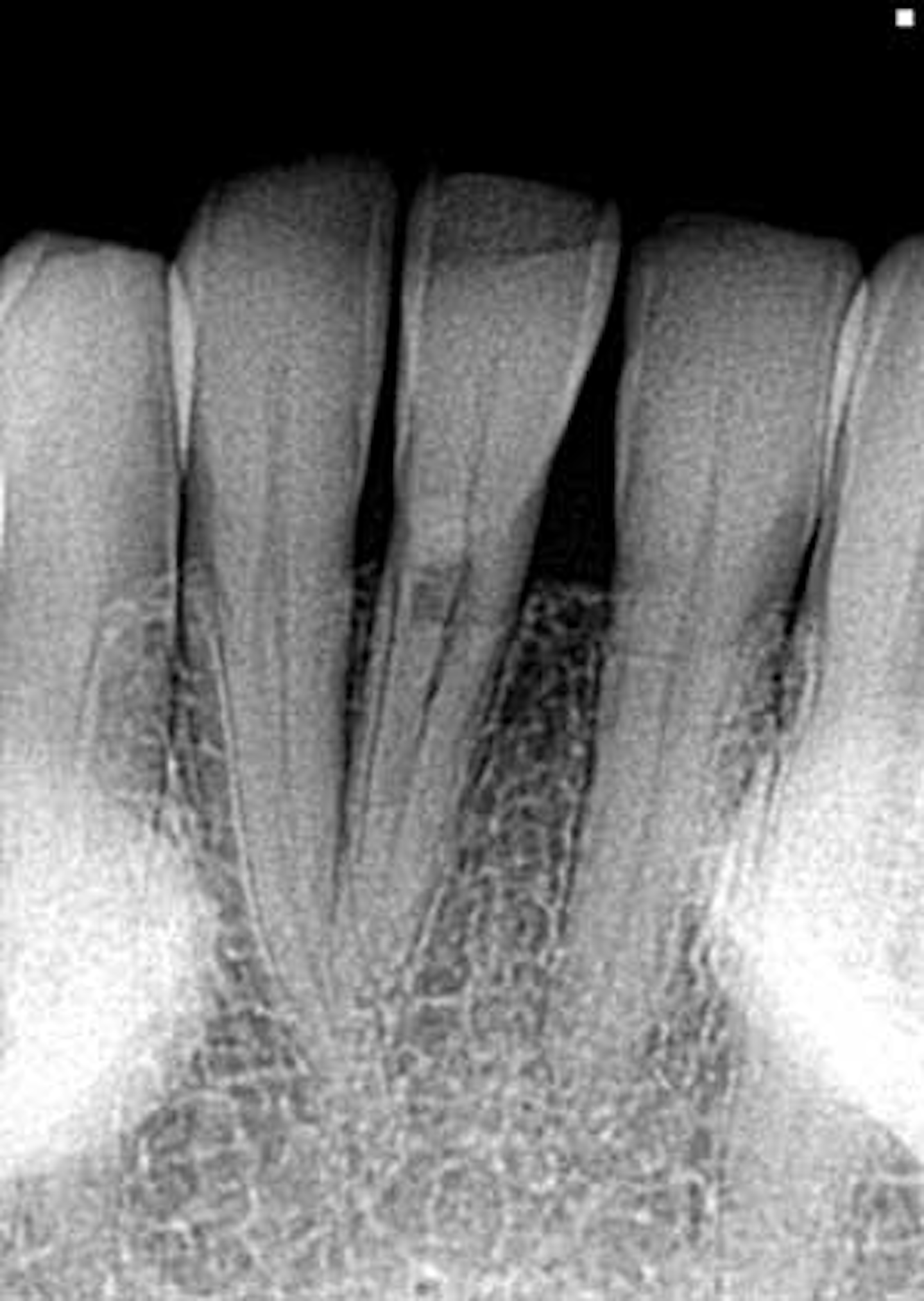 Endodontics reference guide: Distinguishing differences between ...