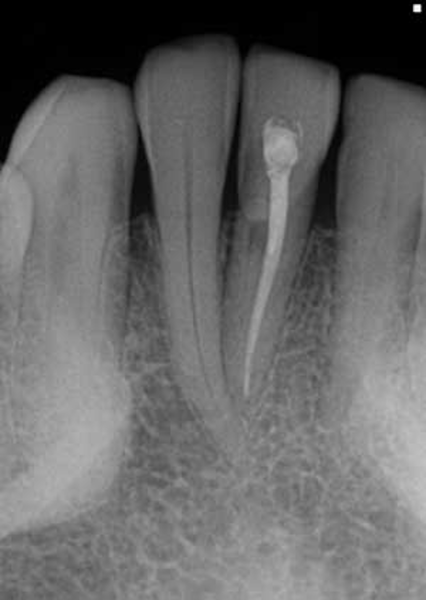 Endodontics reference guide: Distinguishing differences between ...