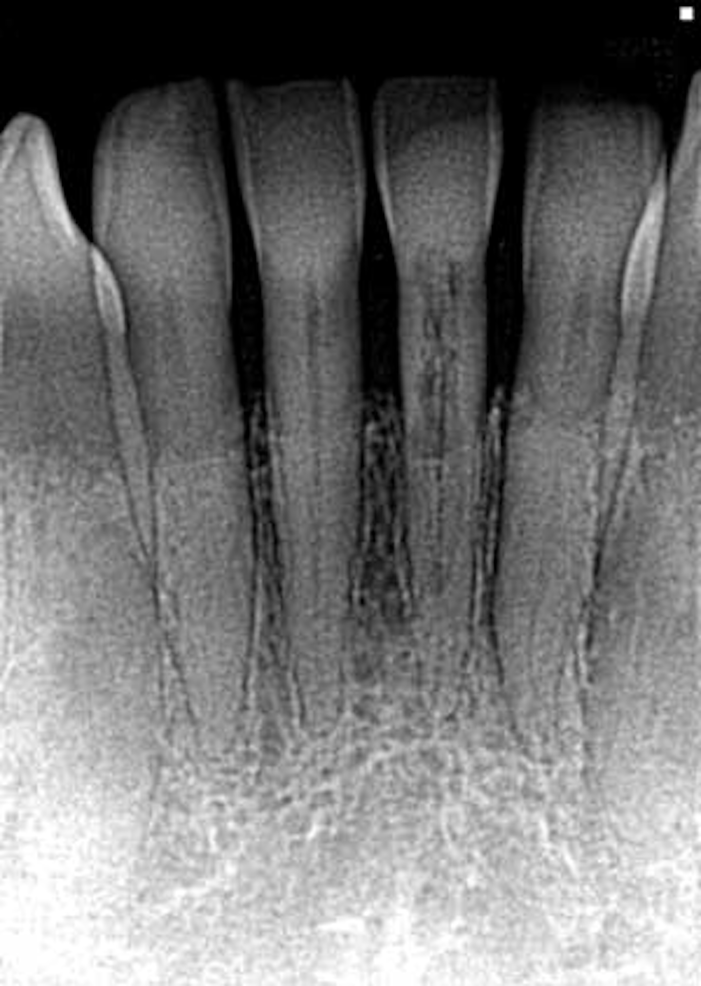Endodontics reference guide: Distinguishing differences between ...