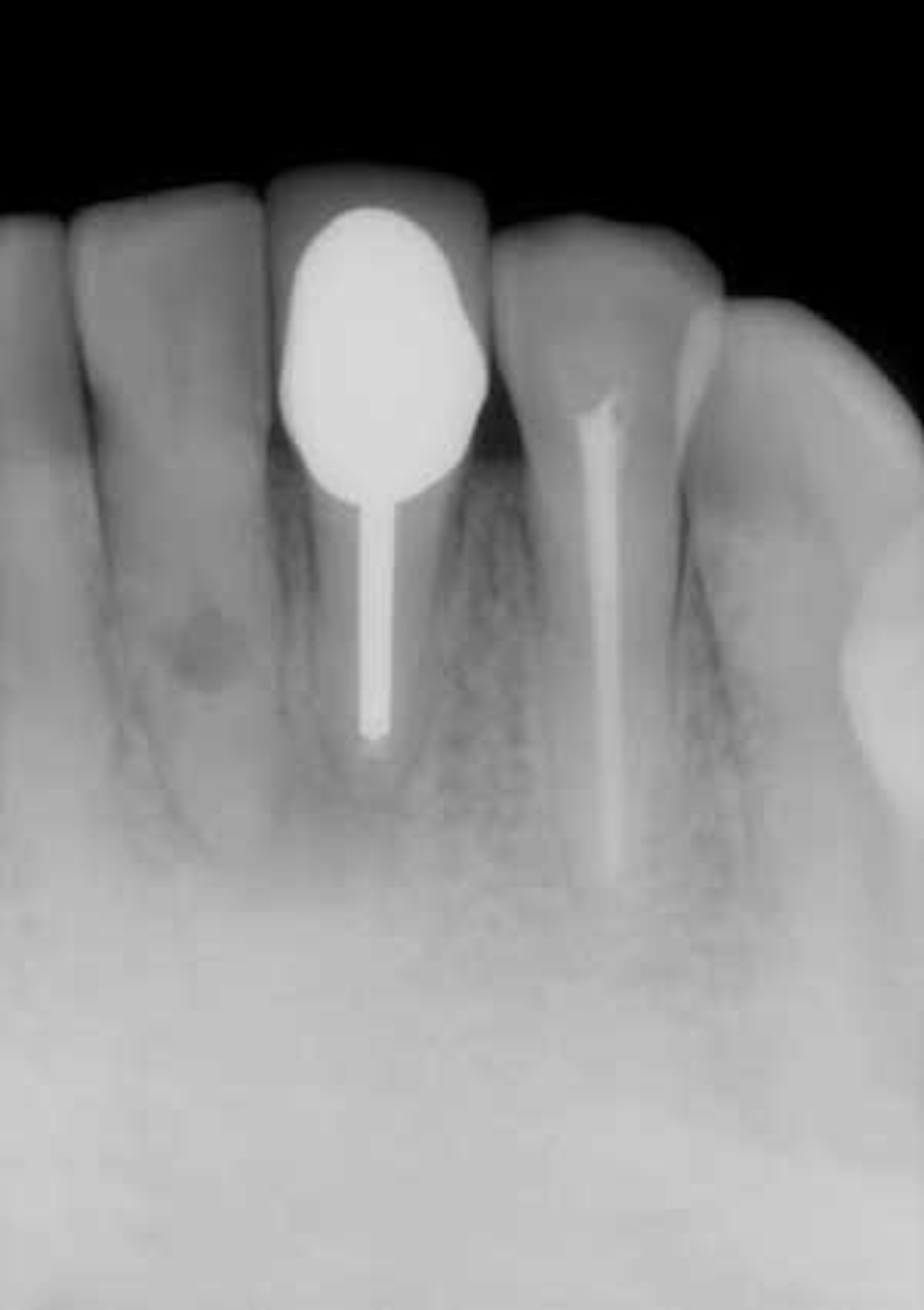 Endodontics reference guide: Distinguishing differences between ...