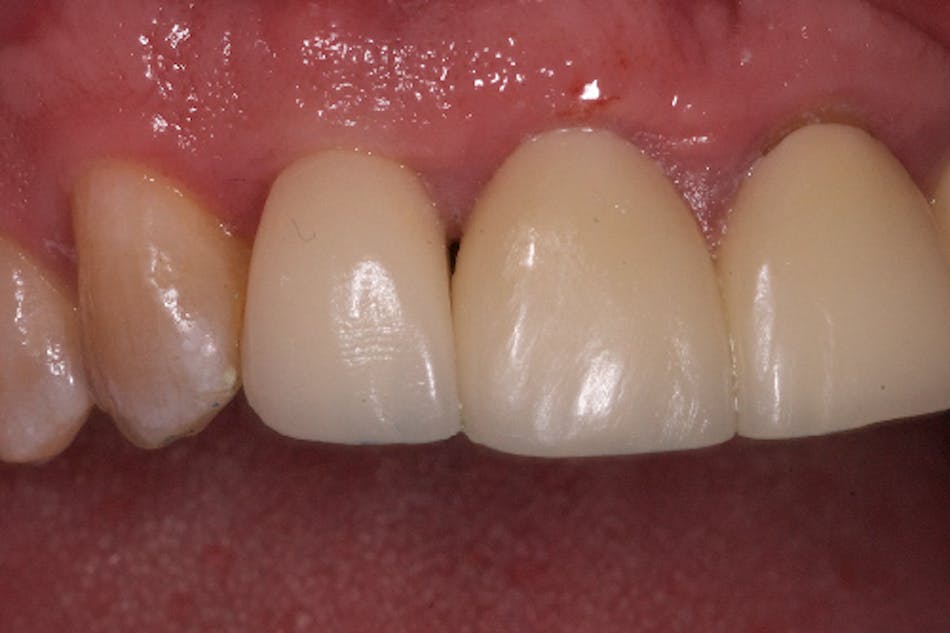 Cross-polarized reflective light dental photography: The silver bullet ...