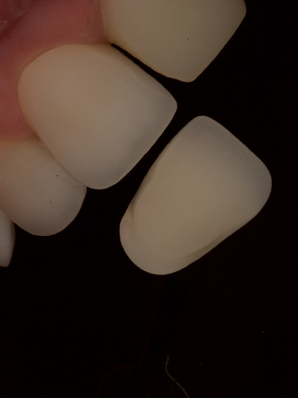 Cross-polarized reflective light dental photography: The silver bullet ...