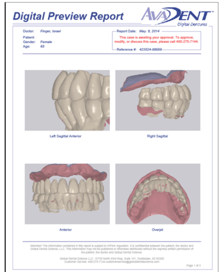 Don't be afraid of dentures: New technology simplifies denture ...