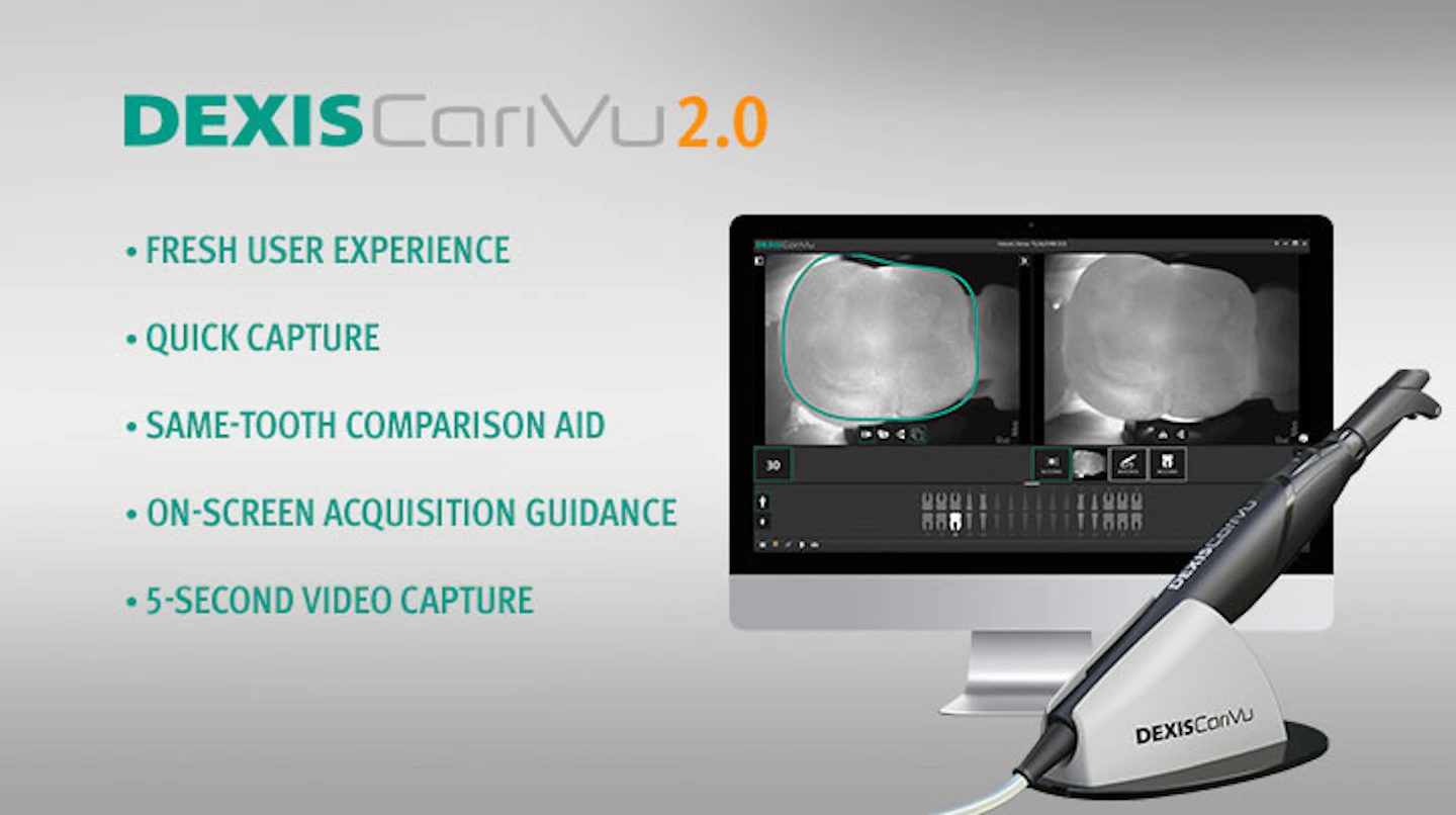 Exciting News For Caries Detection! | DentistryIQ
