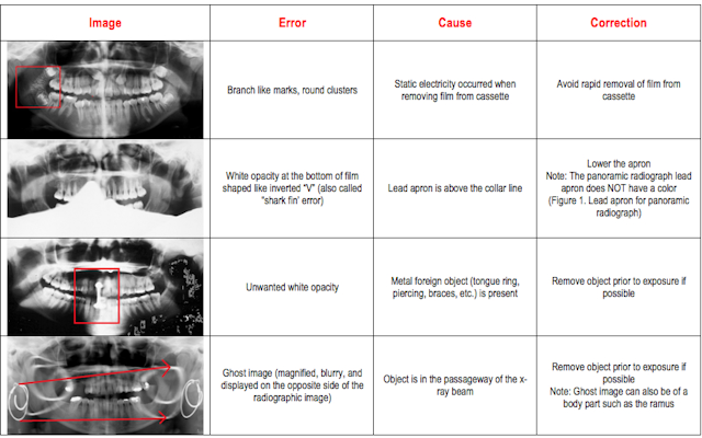 Extraoral panoramic errors: a summary for dental assistants | DentistryIQ