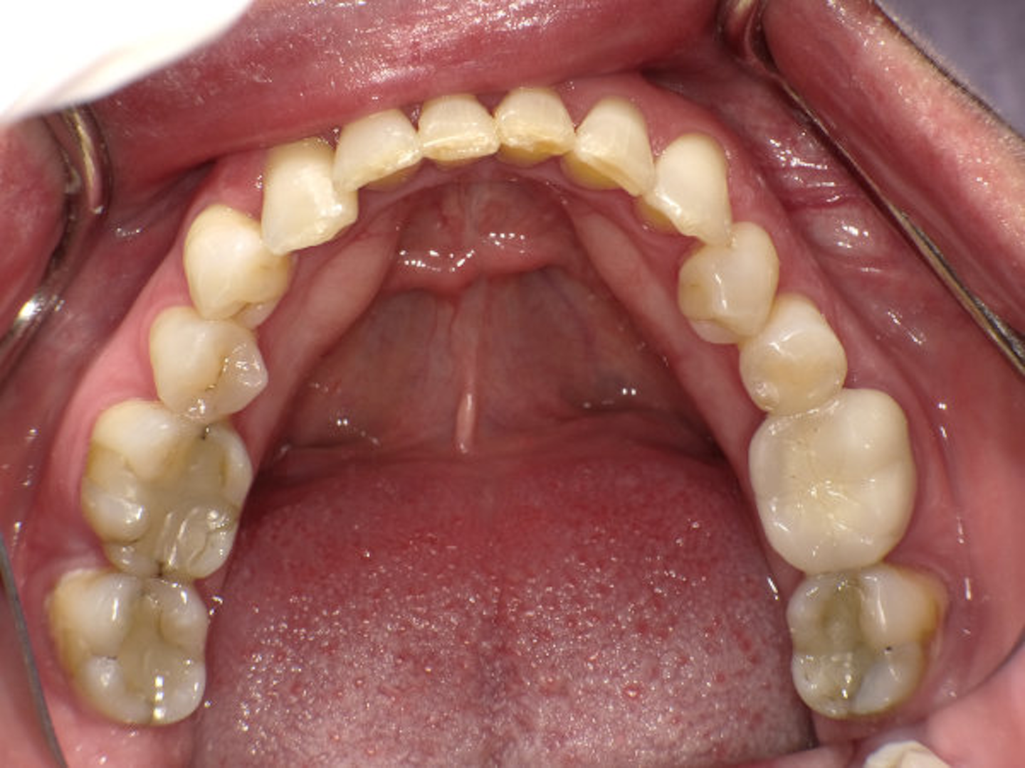 Periodontal disease case study: How trust overcame a dental phobia and ...