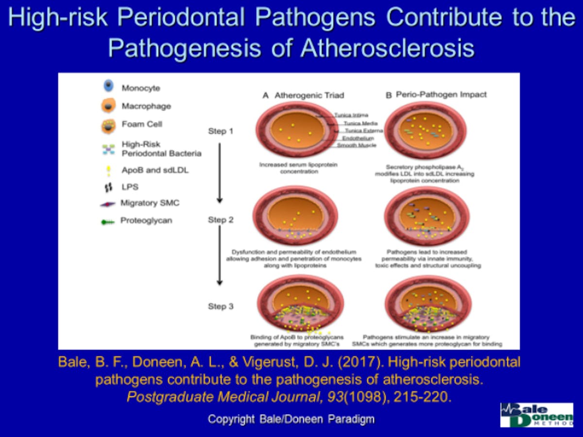 Bacteria from oral infections and cardiovascular disease: Understanding ...