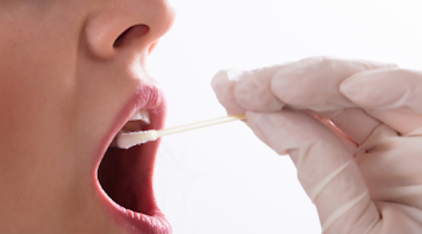 Why salivary diagnostics for dental practices? | DentistryIQ Why salivary diagnostics for dental practices? | DentistryIQ