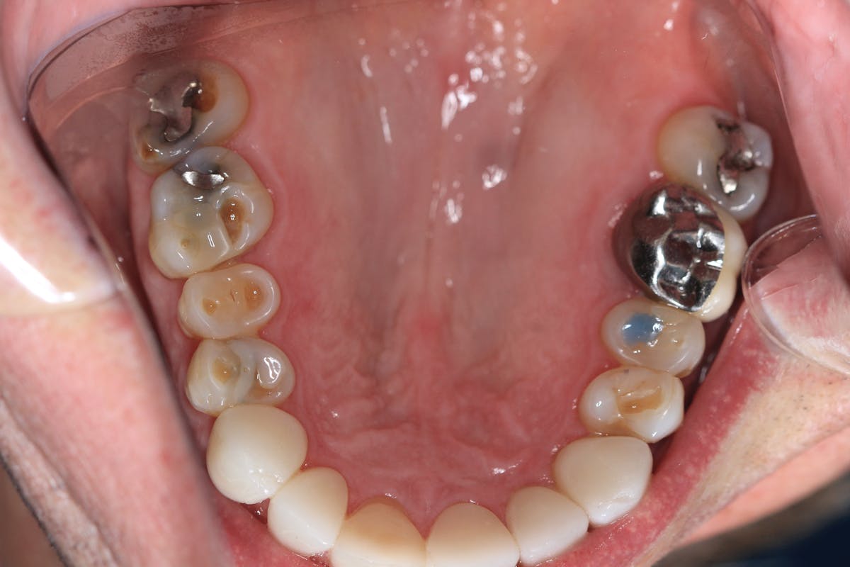 Take this patient and let’s see how your treatment plan compares to ...