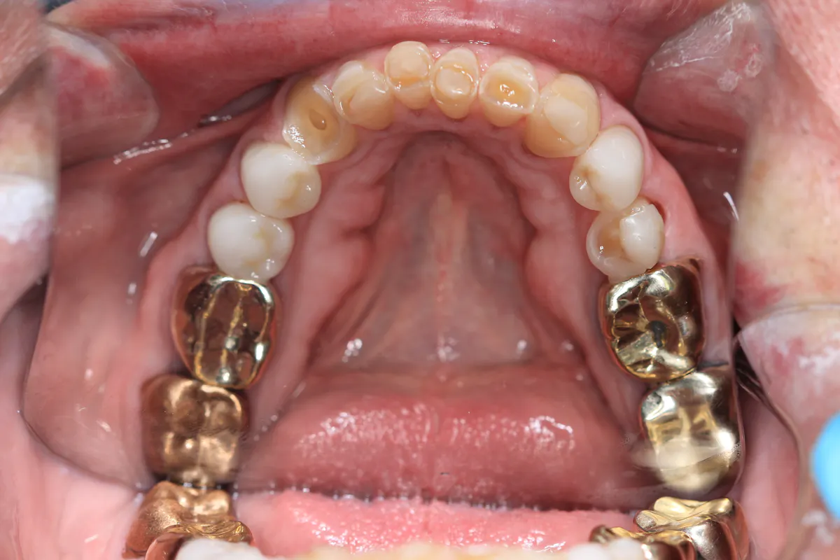 Take this patient and let’s see how your treatment plan compares to ...