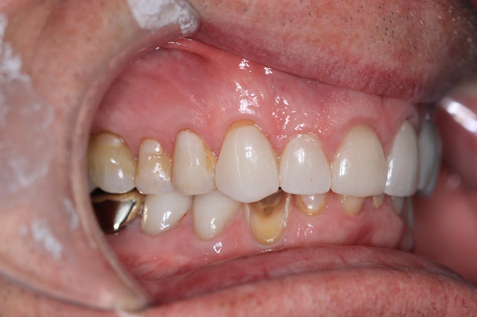 Take this patient and let’s see how your treatment plan compares to ...