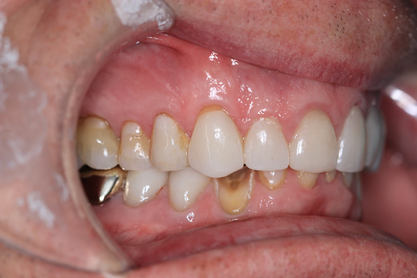 Take this patient and let’s see how your treatment plan compares to ...