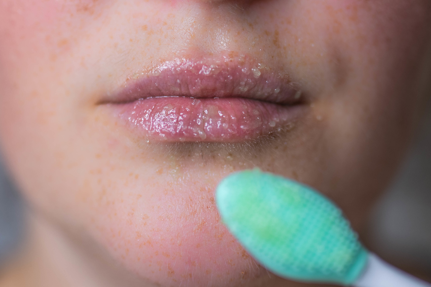 Dental assistants: Does your practice work on lips? | DentistryIQ