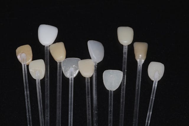 One of my favorite things right now: Custom composite shade tabs ...