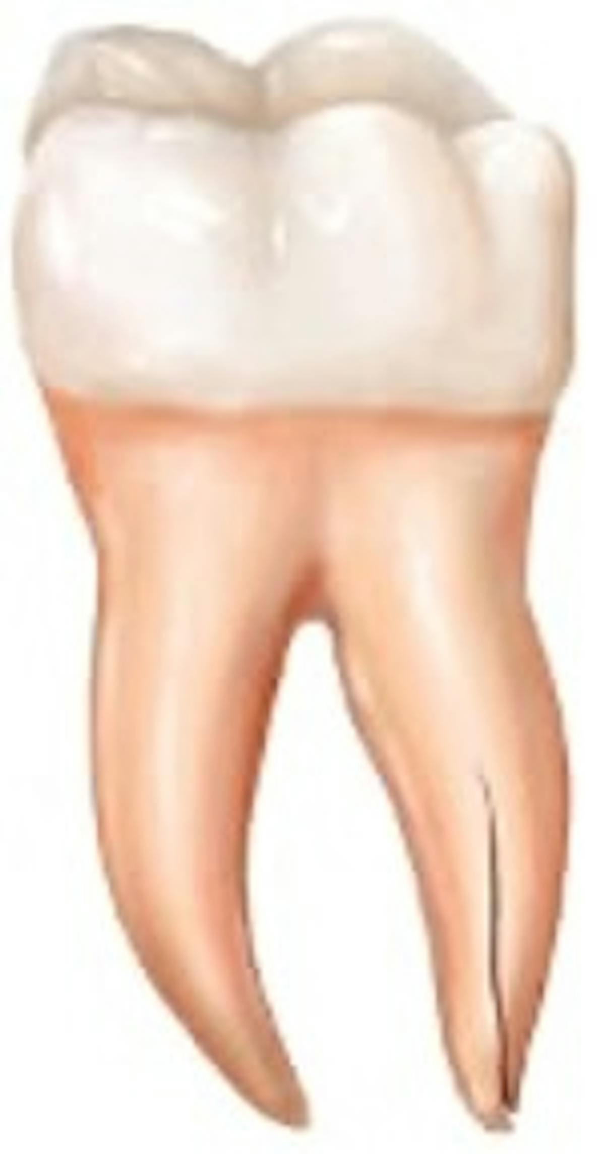 Cracked tooth: Types, causes, and treatments | Dentistry IQ