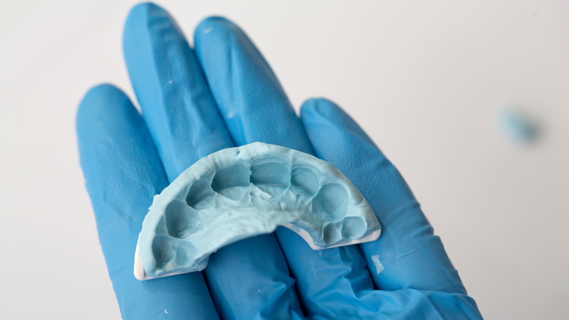 Jaw sprain or jaw strain symptoms and treatments | Dentistry IQ