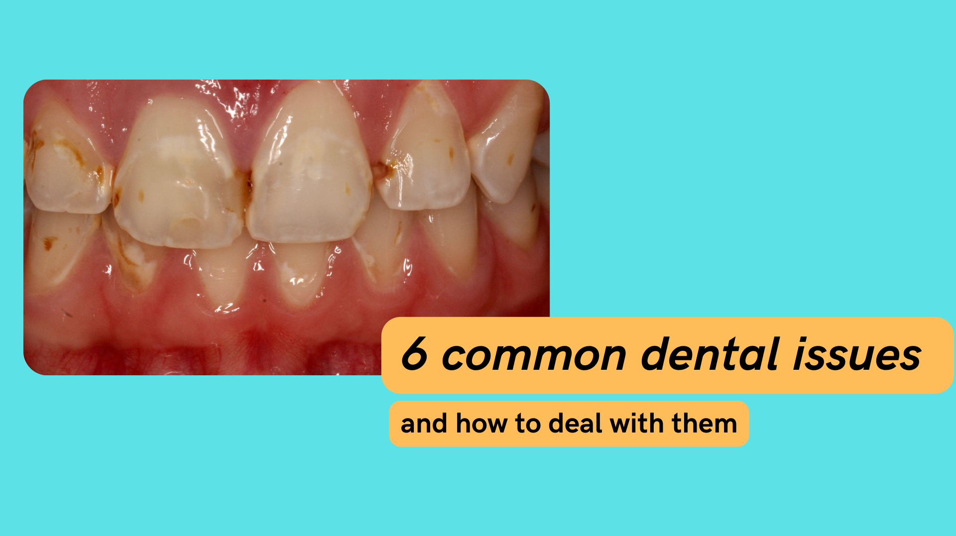6 common dental problems—and how to fix them | Dentistry IQ