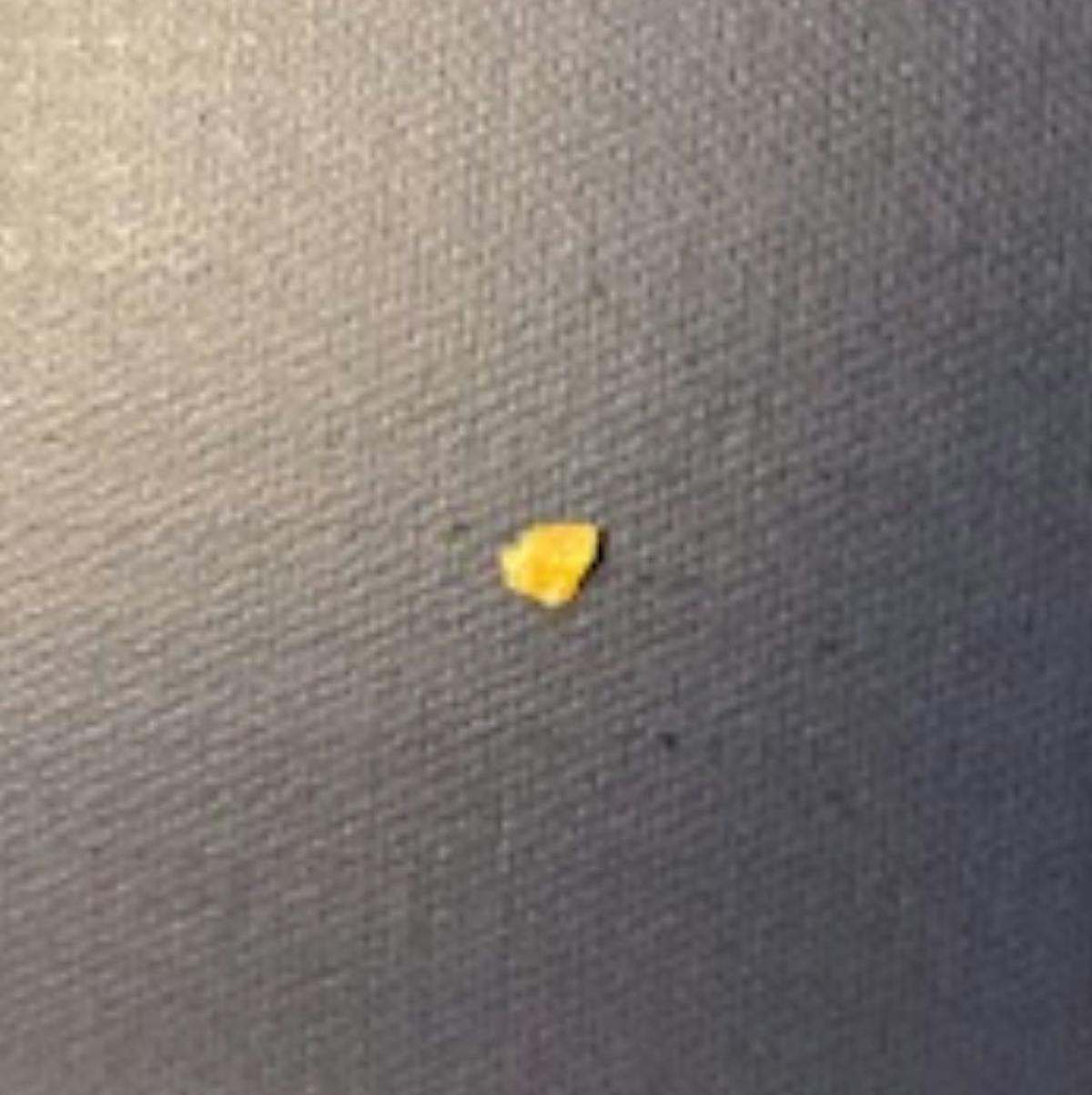 Periodontal abscess or gingival abscess? The perils of popcorn: A ...