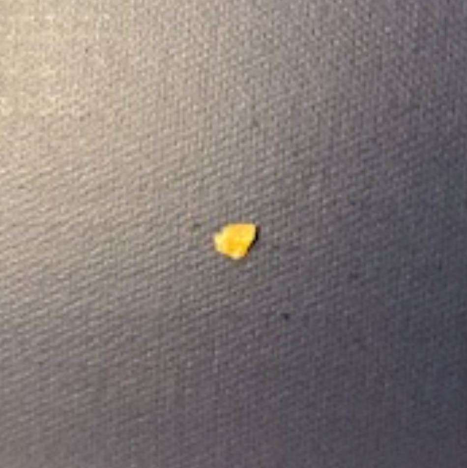 Periodontal abscess or gingival abscess? The perils of popcorn: A ...