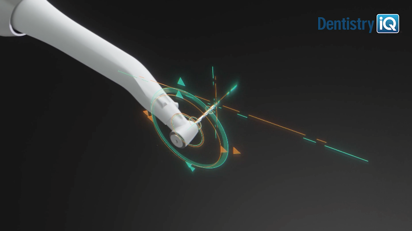 Success in 7 Minutes: Yomi by Neocis | Dentistry IQ