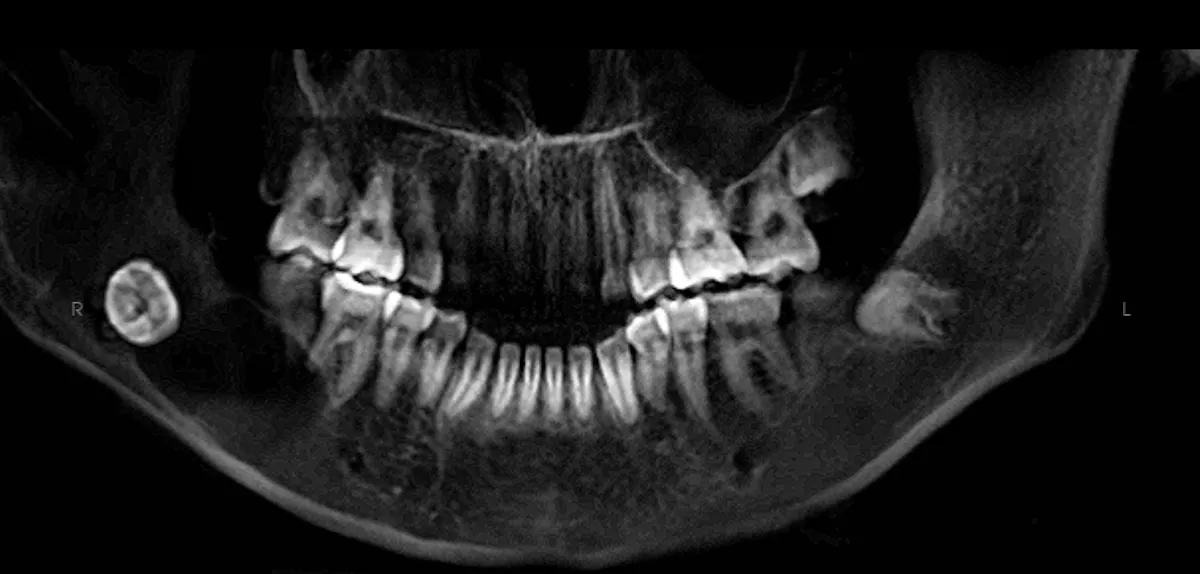 Diagnosis and treatment for Breakthrough Clinical pathology case: No. 4 ...